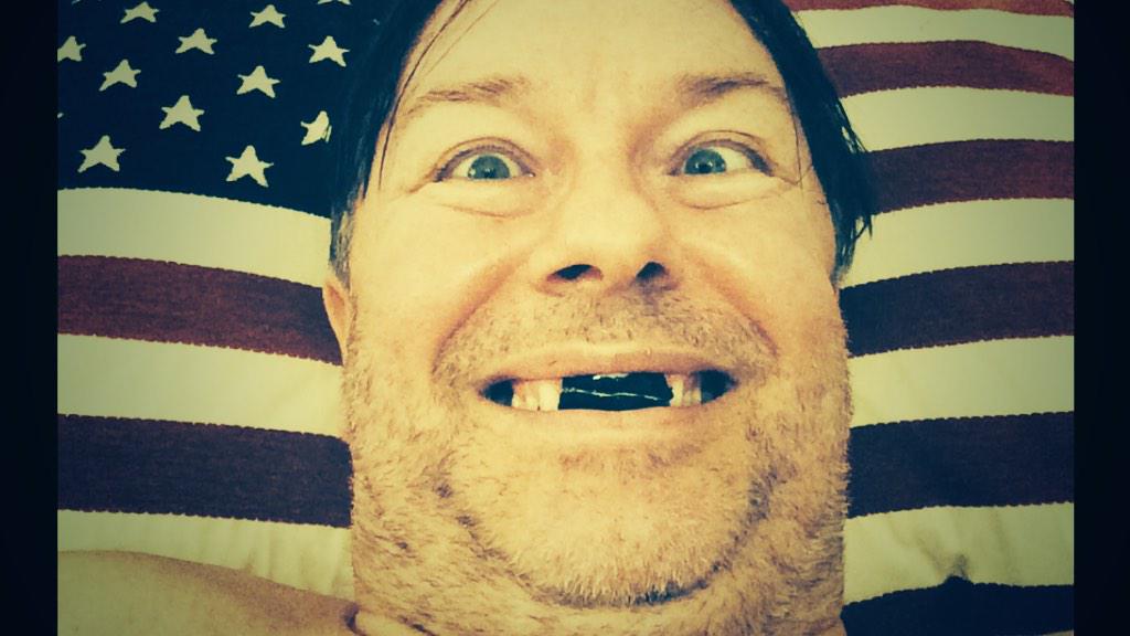 Ricky Gervais Teeth