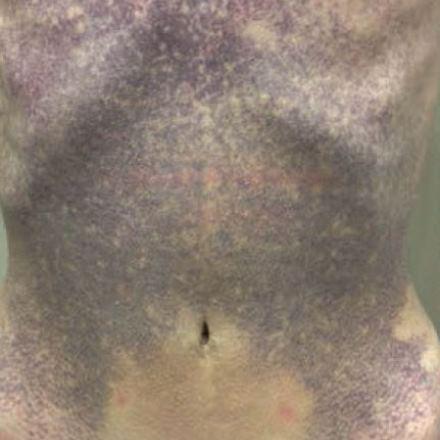 Chimera Skin Pattern The Spawn Of Shadowreck Preview #6 | Plaid Hat