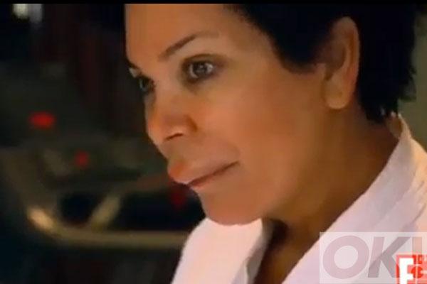 Kris Jenner suffers ANOTHER swollen lip after an allergic reaction ...