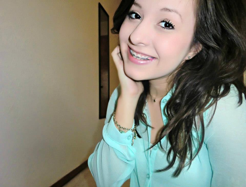 Girls With Braces On Twitter Lovely Braces Zgon7ahgbj