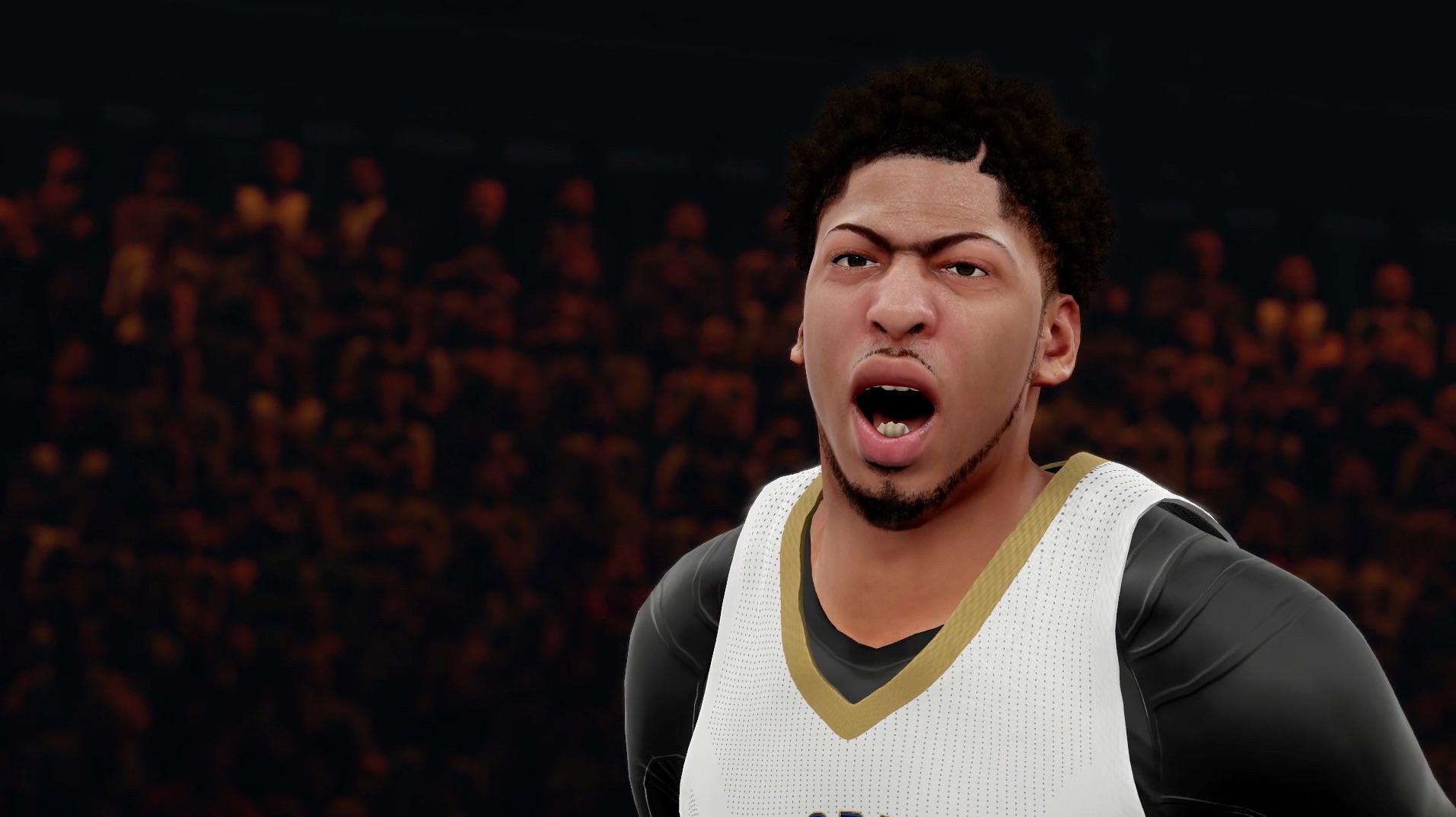 Anthony Davis Teeth Before And After