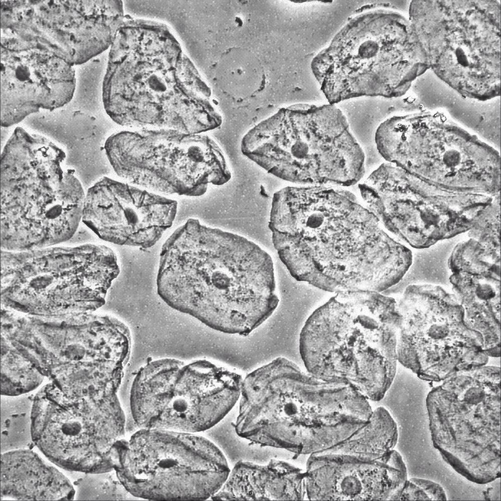 Cheek Cell Under Microscope