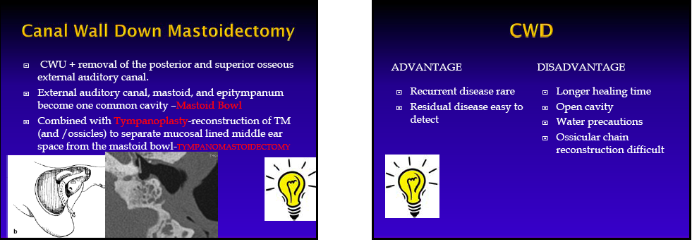 Canal Wall Up Mastoidectomy