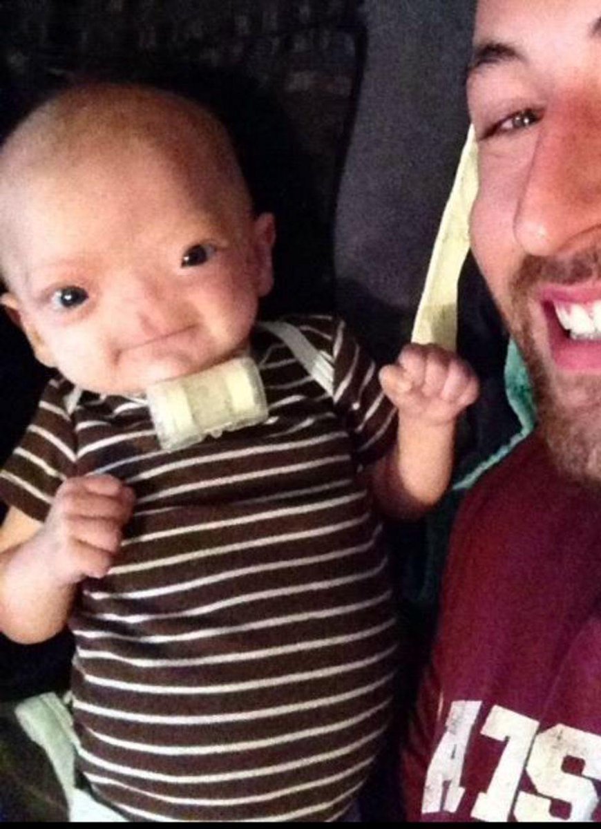 Baby Eli: Remember beautiful Baby Eli? The Mobile baby born without a ...