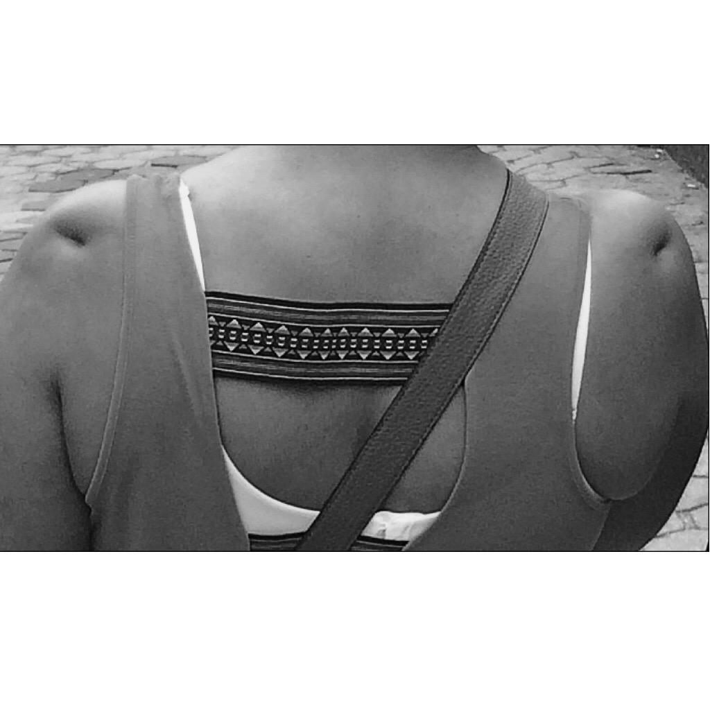 Shoulder Dimples Genetic