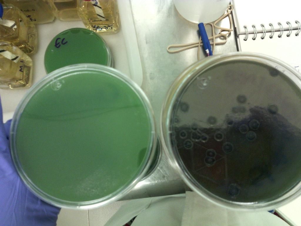 Bismuth Sulfite Agar