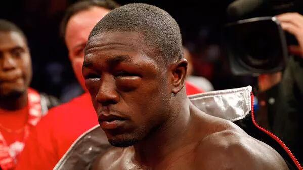 See How Bad Andre Berto's Face Is After Fighting Mayweather On Saturday ...