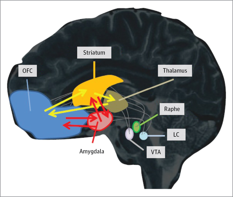 Orbitofrontal Cortex Ocd