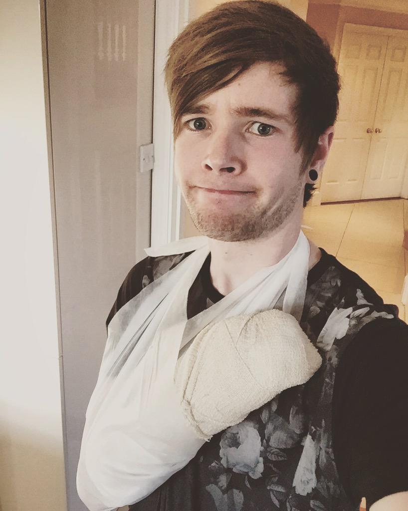Broken Neck Cast