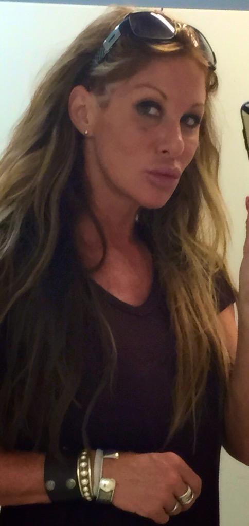 Farrah Dahl On Twitter Look At My Cool Bolt Theshocker Black Eye