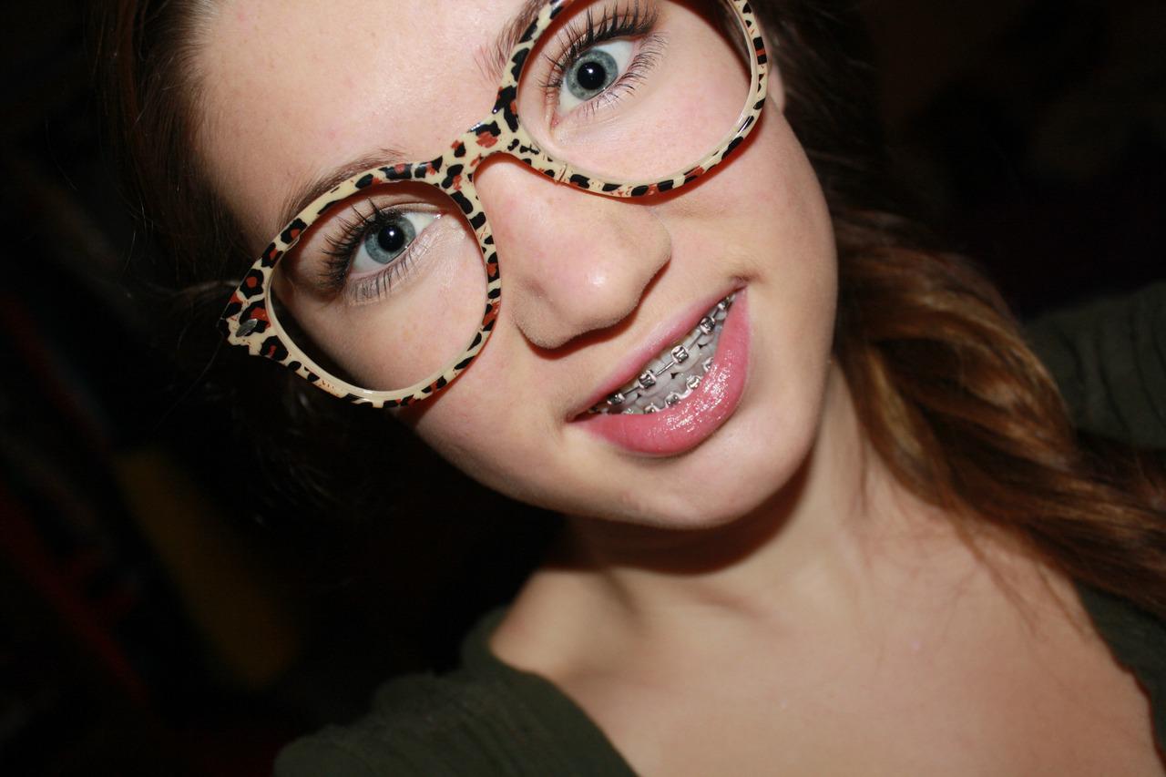 Girls With Braces On Twitter Cute Frame And Braces Braces T