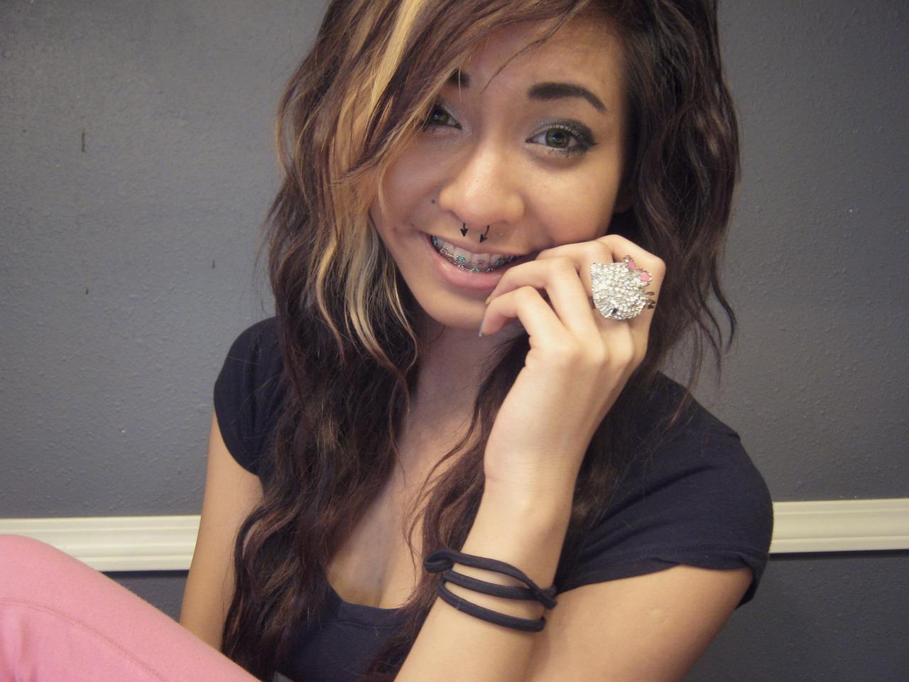 Girls With Braces On Twitter Braces Look Awesome Braces