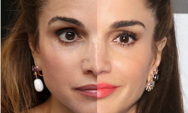 Rania: #RoyalNews Rania de Jordania, ¿se sometió a una cirugía plástic...