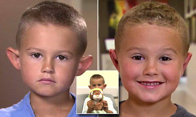 This little guy got plastic surgery for his 'elf ears' after he was ...