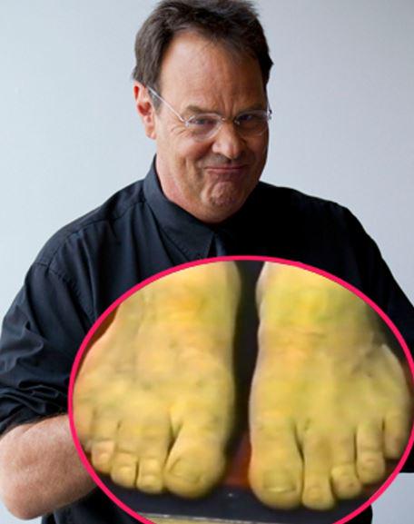 Dan Aykroyd Webbed Feet