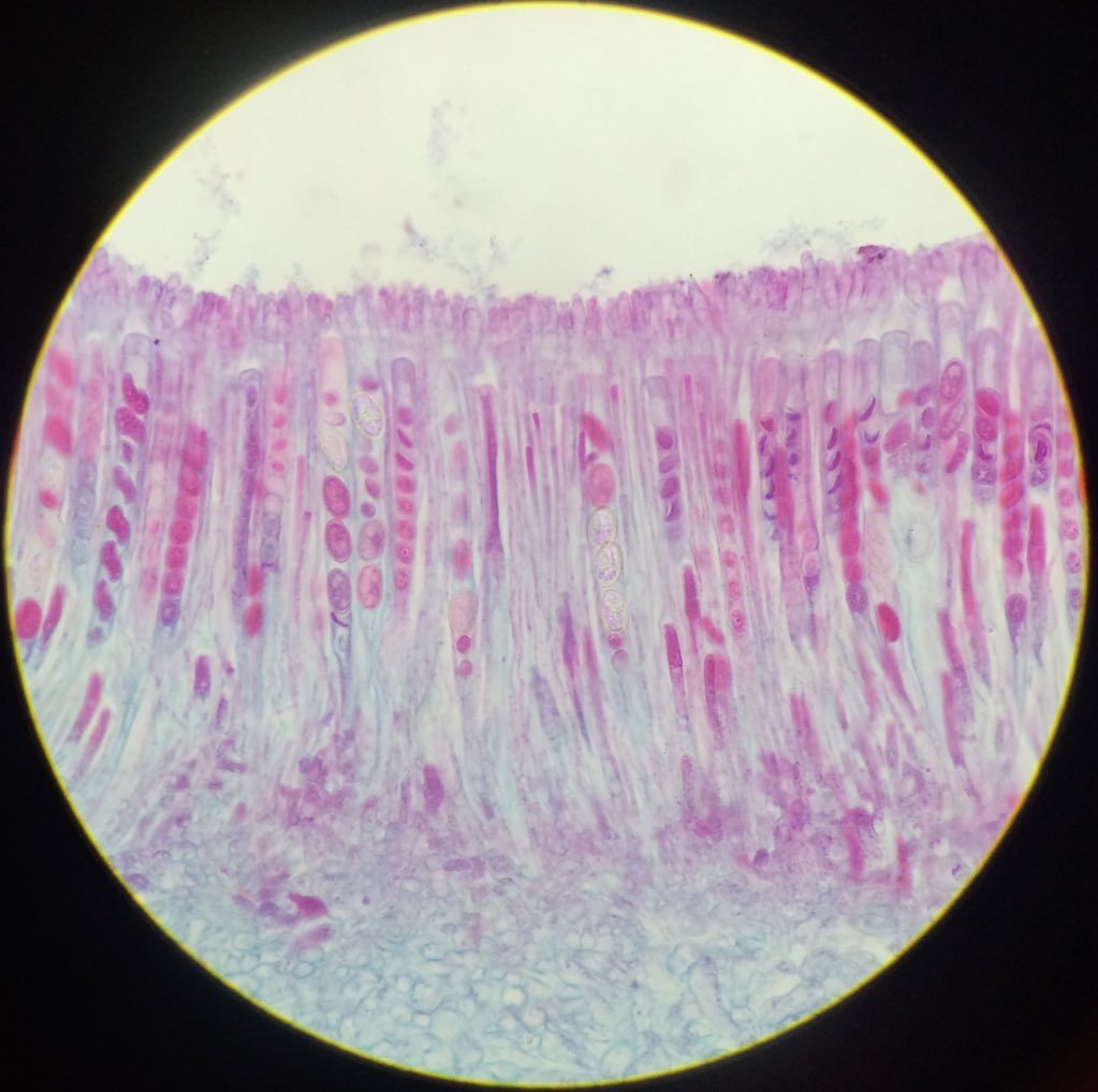 Peziza Under Microscope Labeled