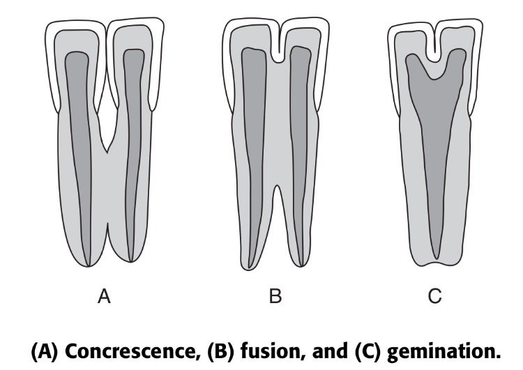 Concrescence Teeth