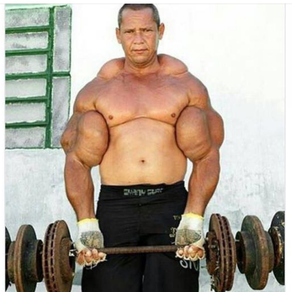 Synthol Infection