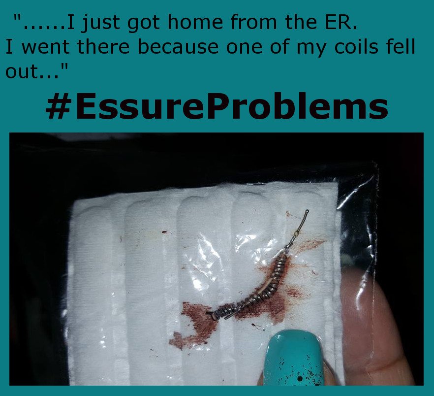 Essure Problems