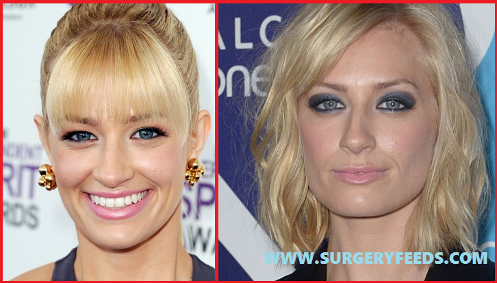 Beth Behrs No Makeup