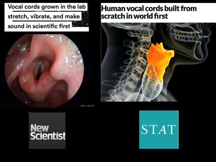 Human Vocal Cords