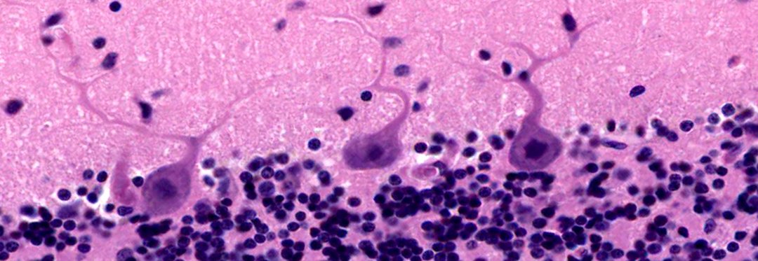 Purkinje Cell Histology