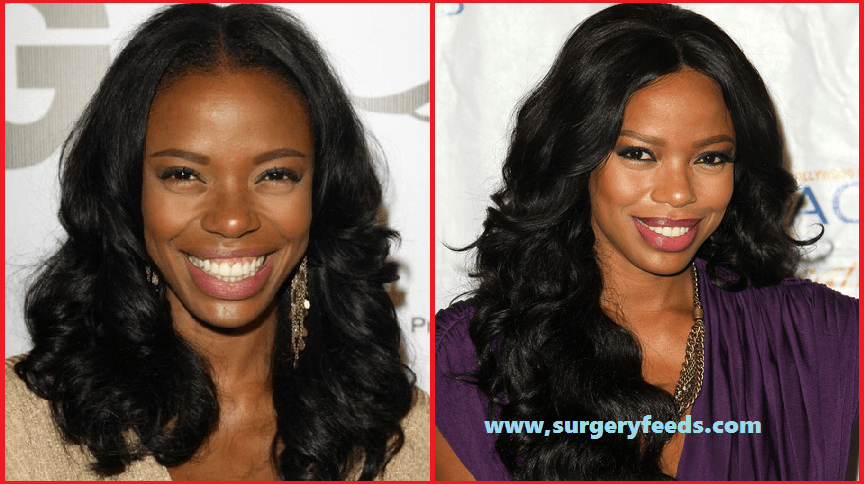 Black Celebrity Before And After Plastic Surgery