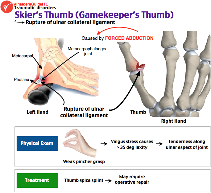 Gamekeepers Fracture