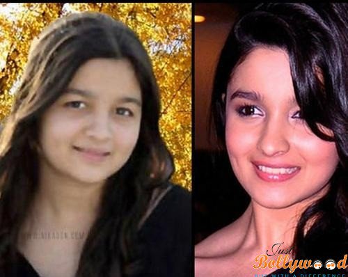 Alia Bhatt Before And After