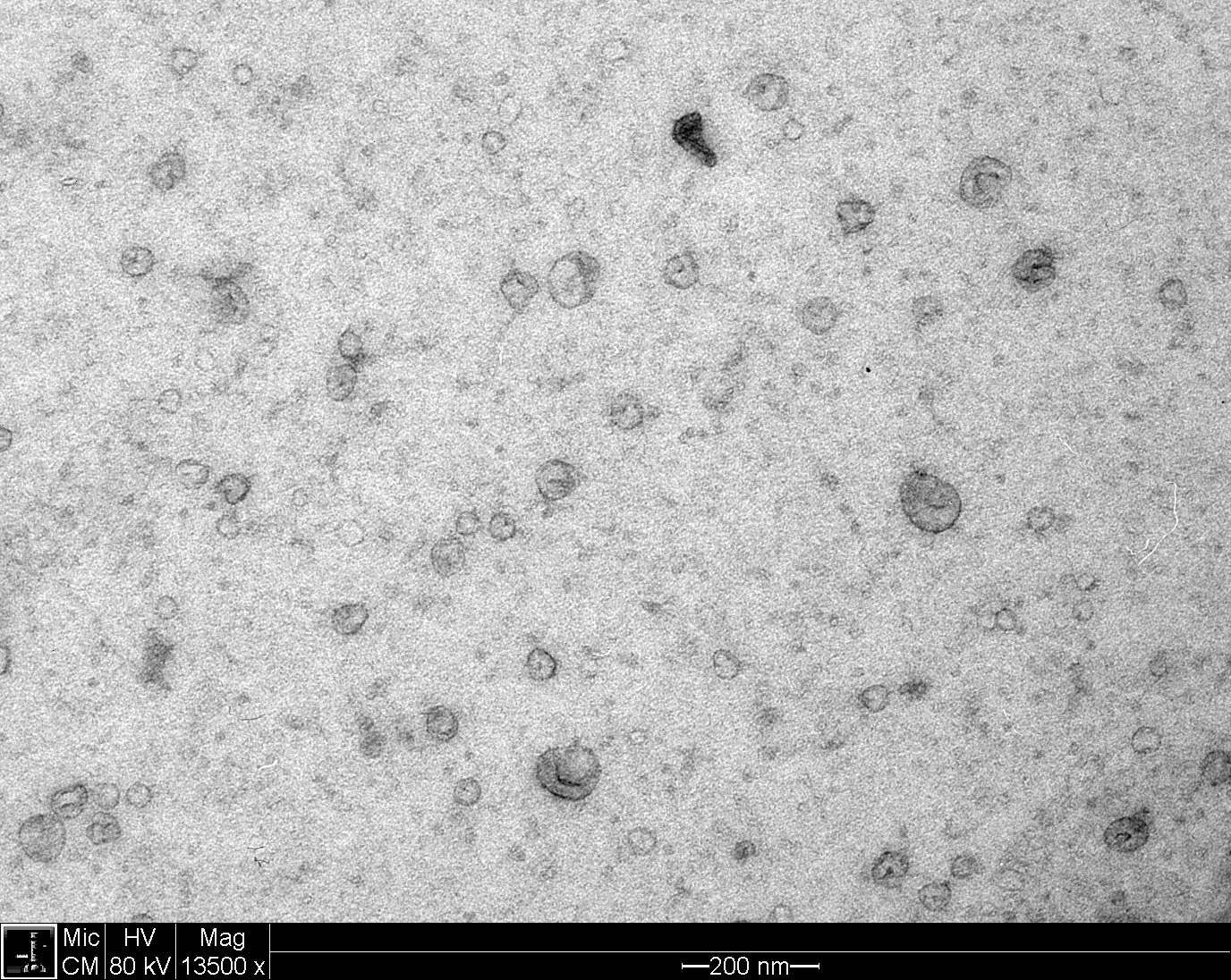 Vesicles Micrograph