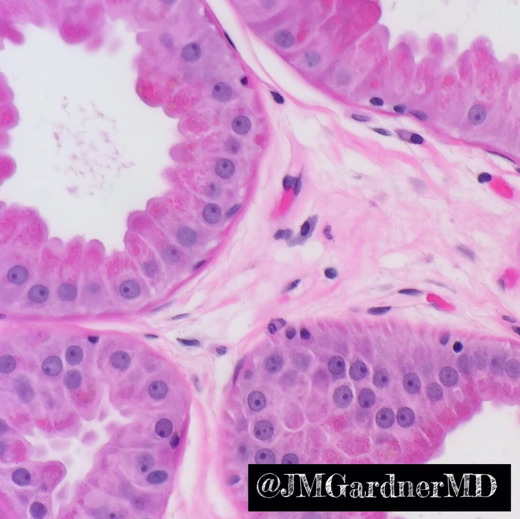 Apocrine Gland Histology
