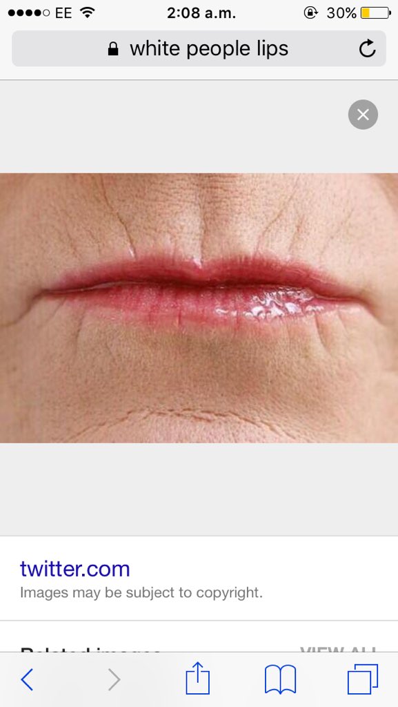 White People Lips