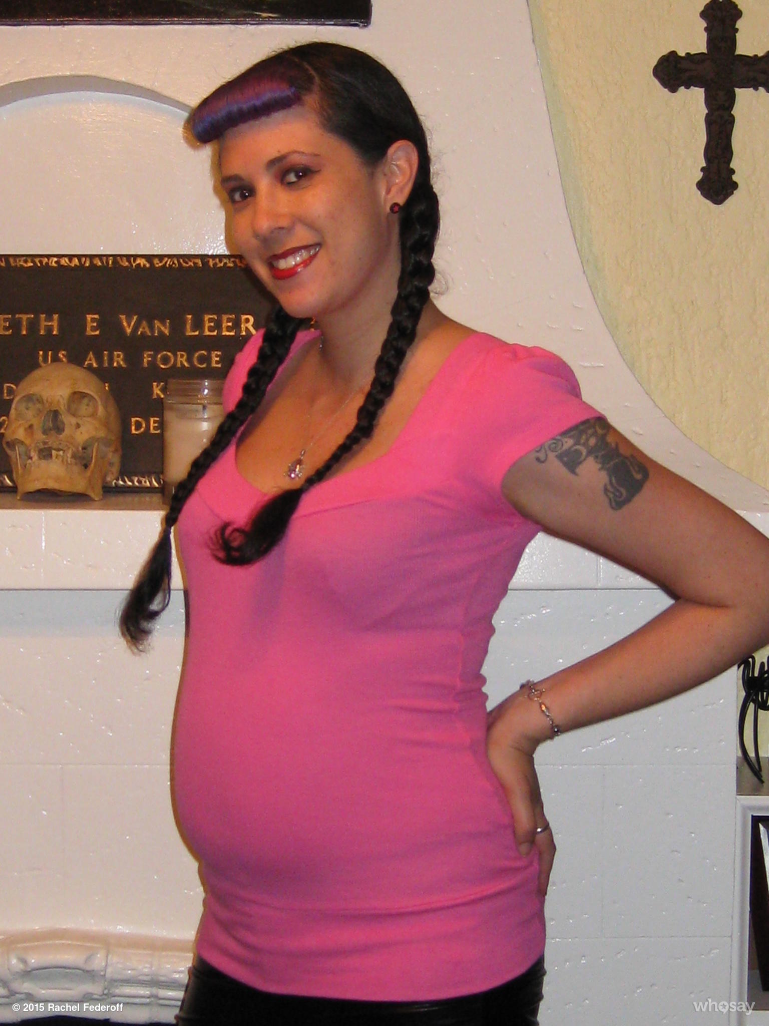 Rachel Federoff Before And After