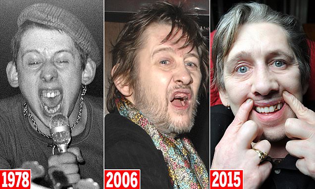 Forget new york - it's a fairytale of new teeth for the pogues singer ...