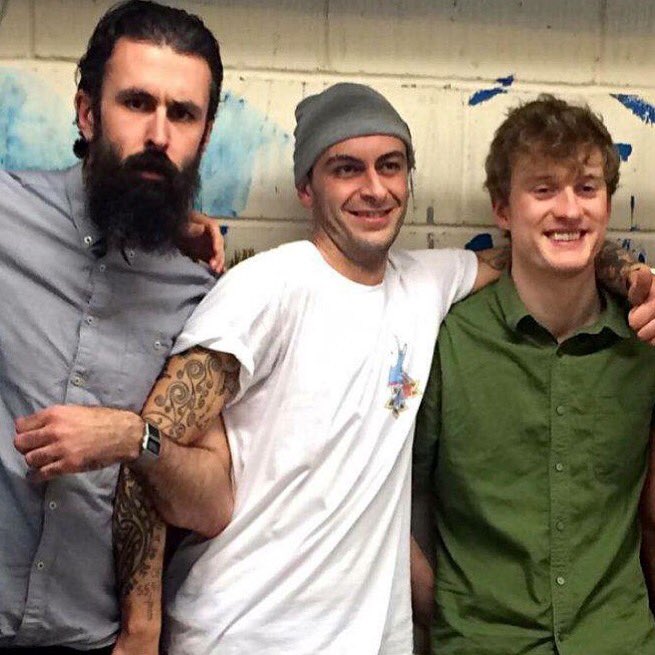 Joseph Gilgun Teeth