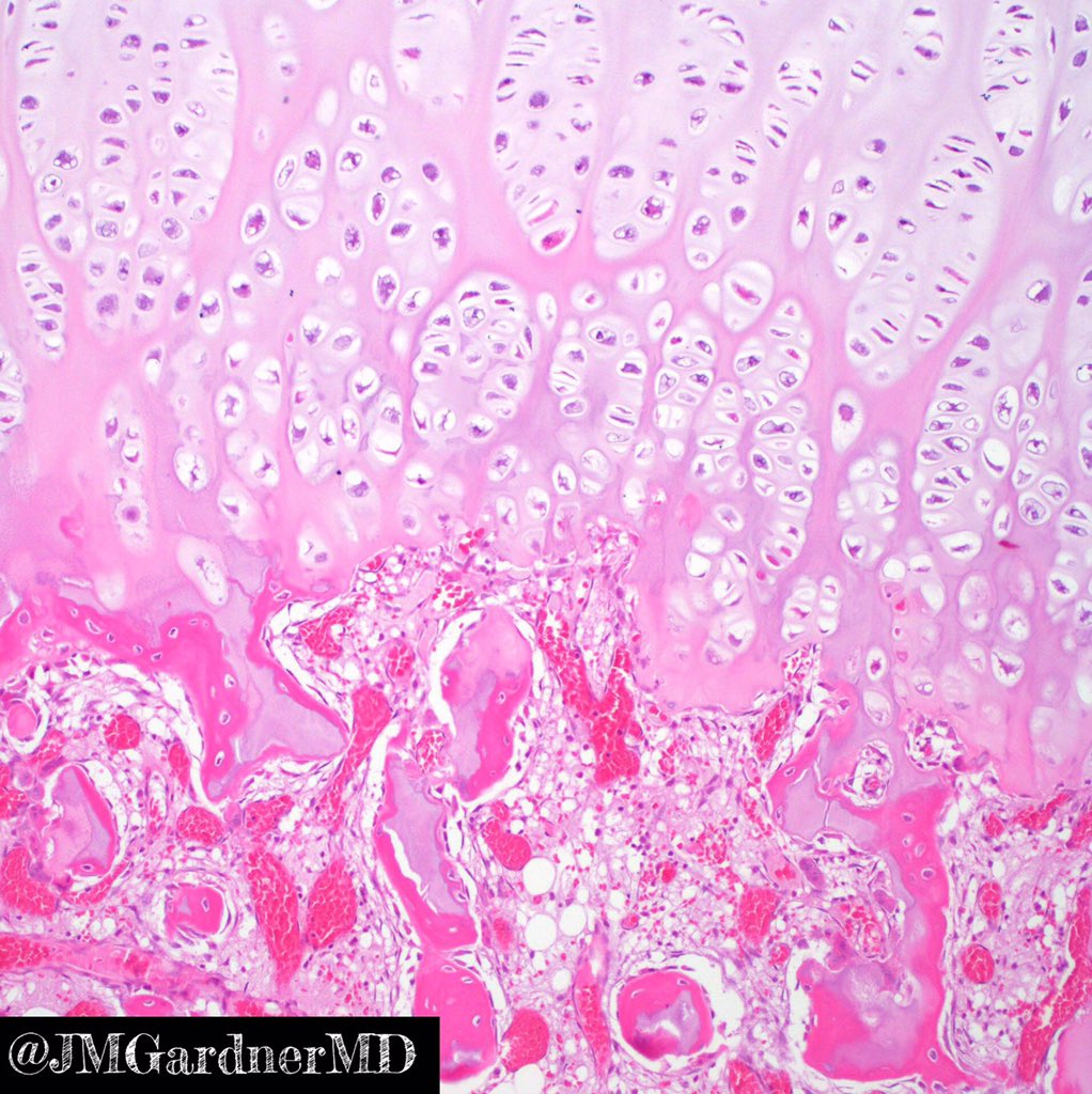 Endochondral Ossification Histology