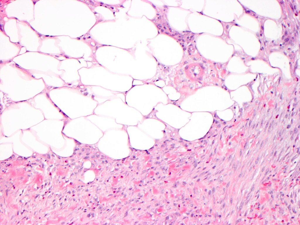 Saponification Histology