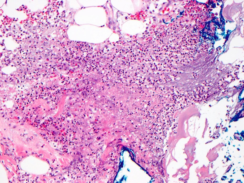 Saponification Histology