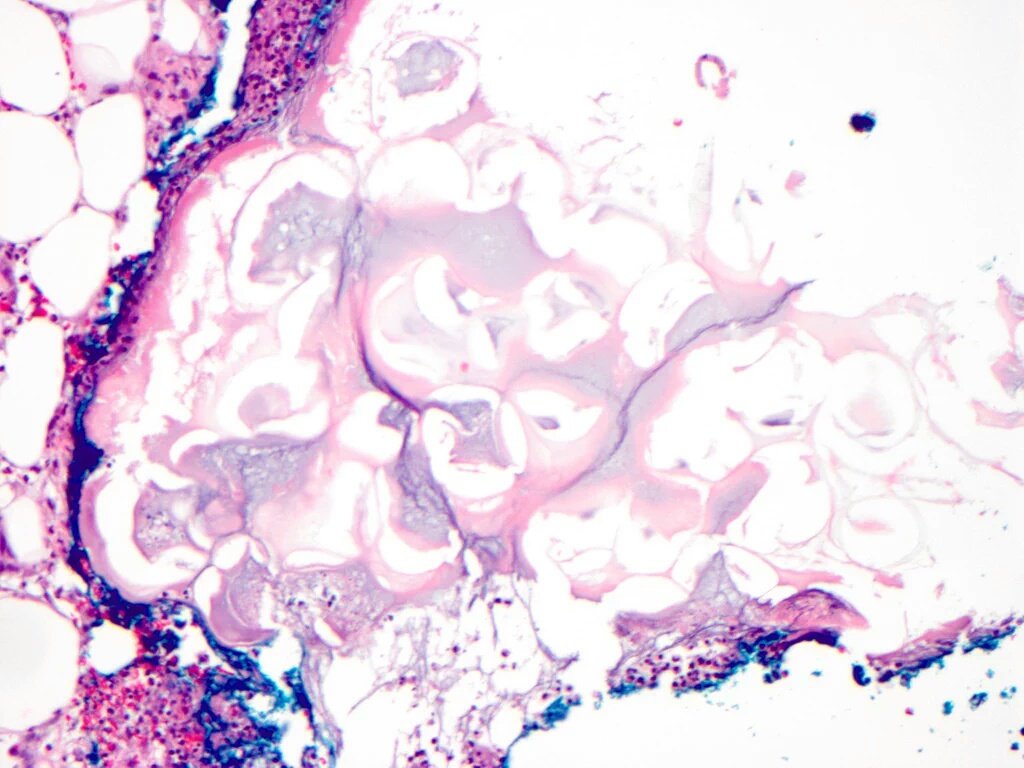 Saponification Histology