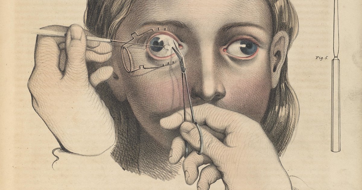 These grisly victorian medical drawings will horrify you - scoopnest.com