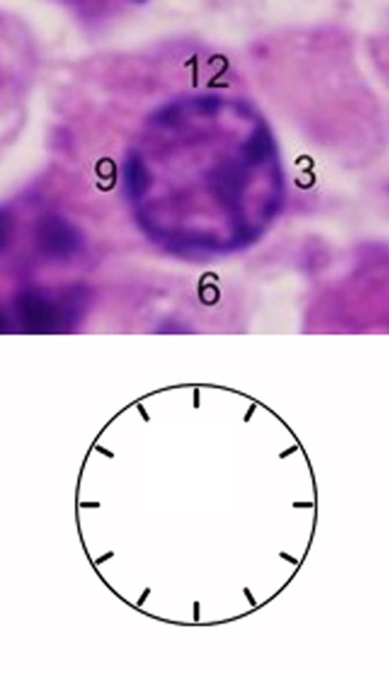 Plasma Cell Clock Face Dividing Plasma Cells In The Cerebrospinal