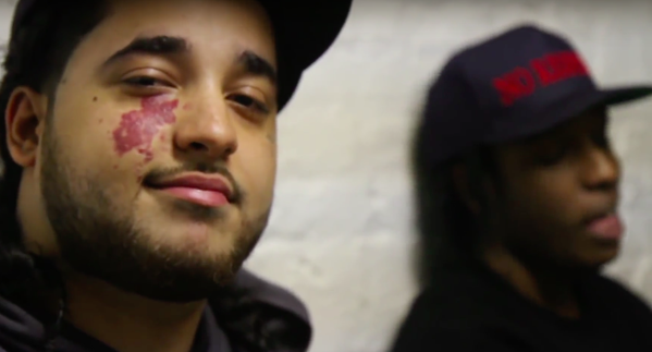 What Happened To Asap Yams Face