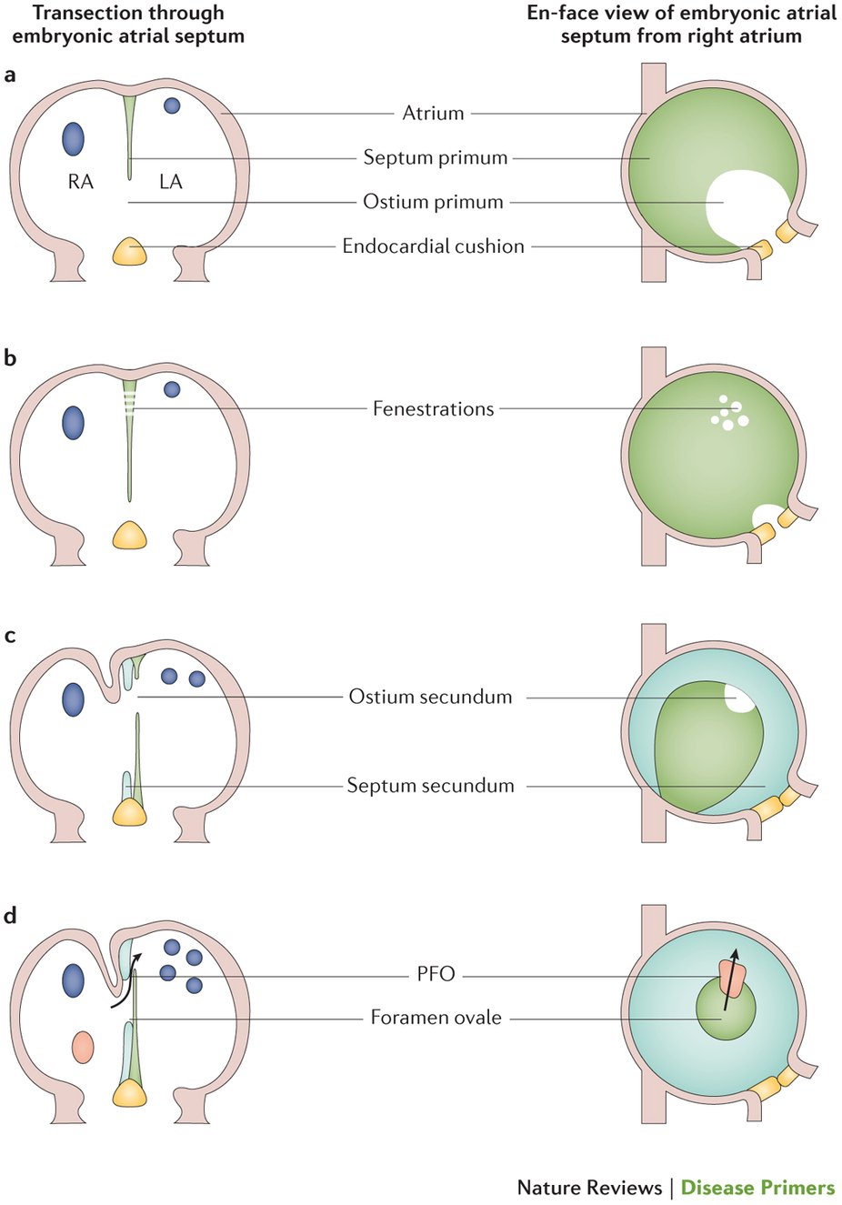 Interatrial Septum Development