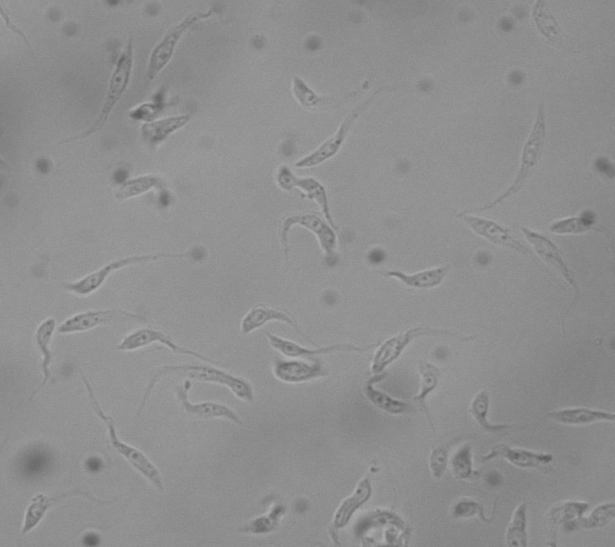 During my PhD I had worked with Procyclic forms. Here is a photo I took ...