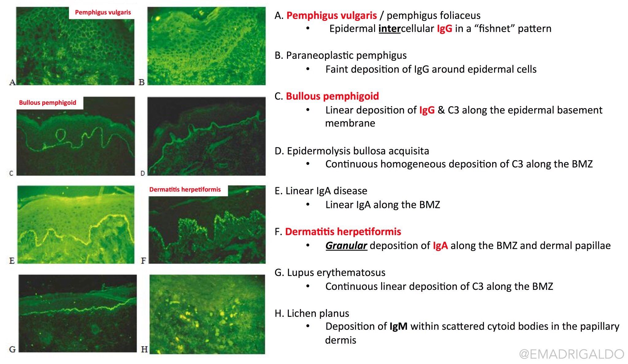Lichen Planus Immunofluorescence