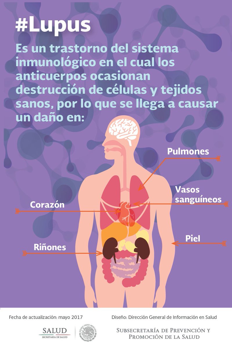 Lupus, ¿Qué es?. Infografía | SALUD México | Scoopnest