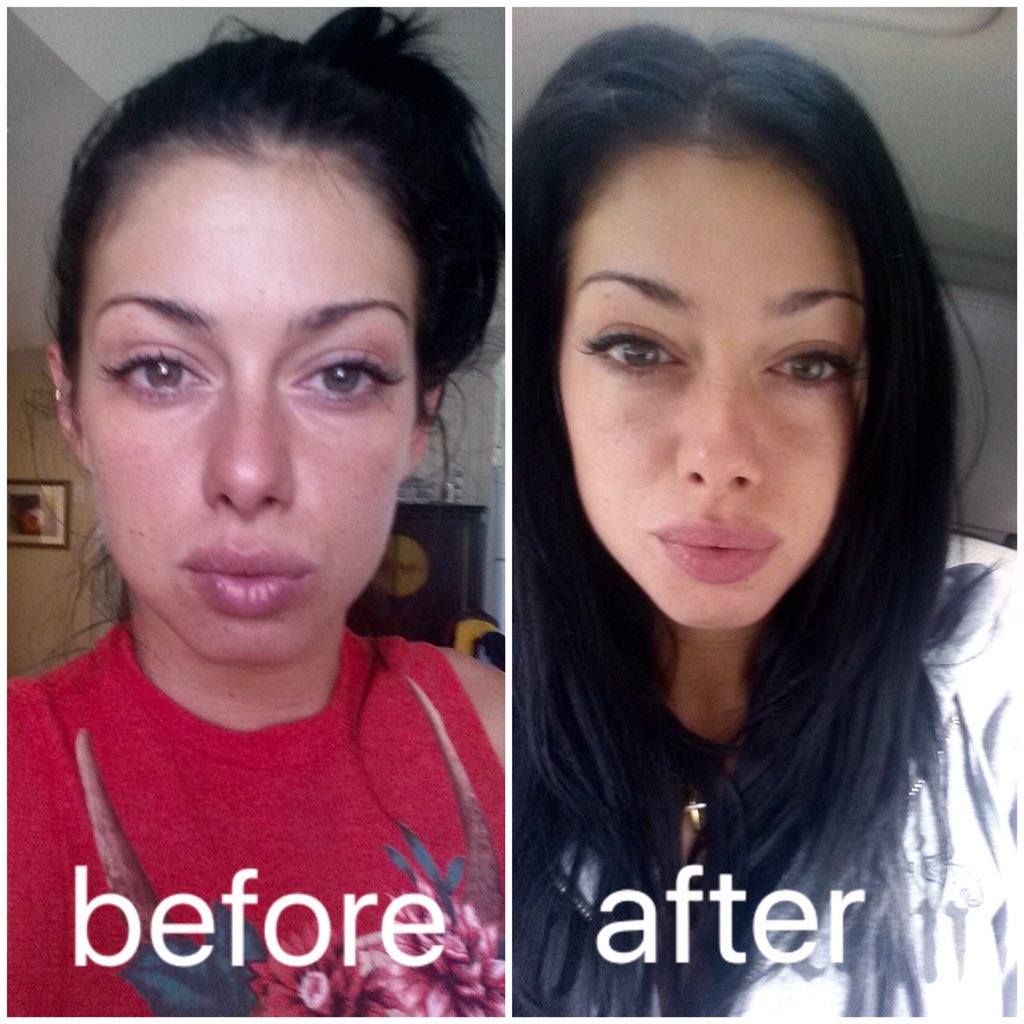 Alcohol Use Before And After