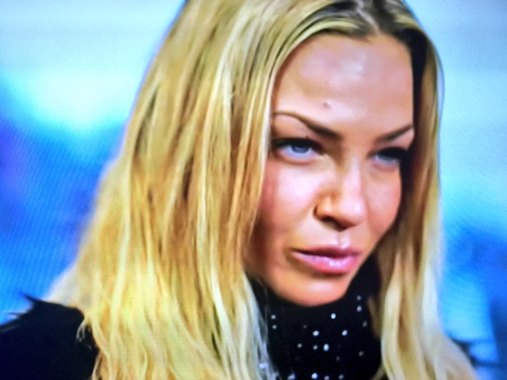 I didn't even recognise Sarah Harding, what's happened to her face ...