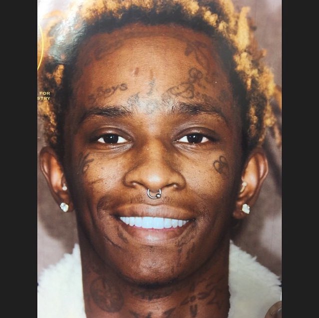 Young Thug Gold Teeth
