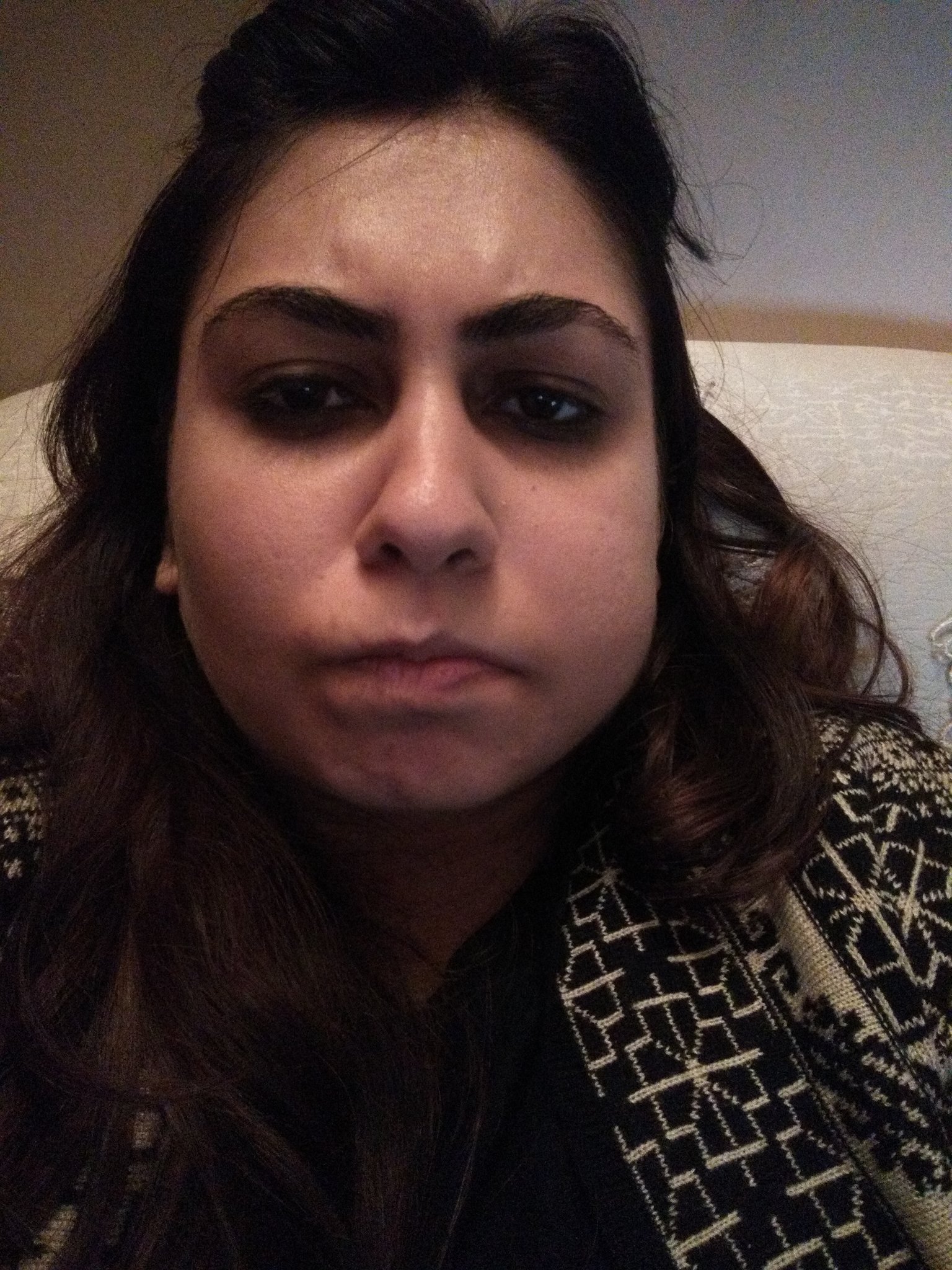 Swollen Face Wisdom Teeth